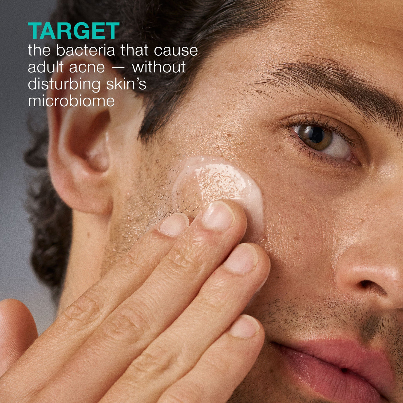 Acne Biotic Moisturizer | Dermalogica®