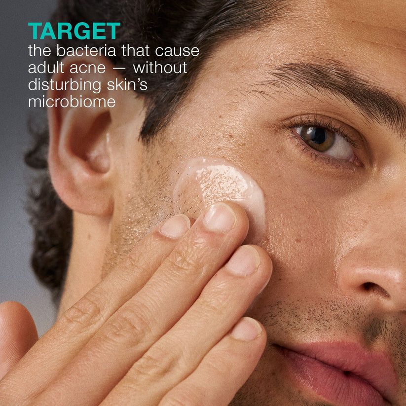 Acne Biotic Moisturizer | Dermalogica®