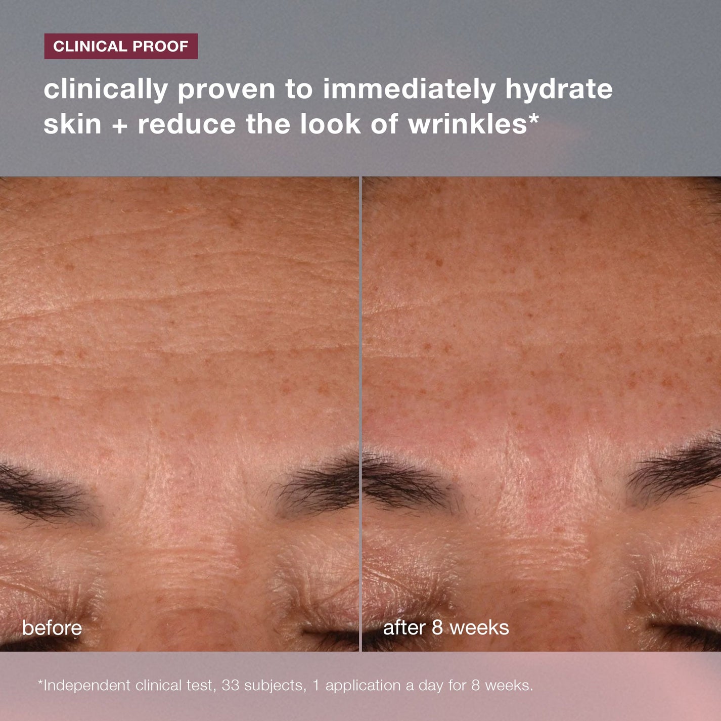Dynamic Skin Recovery SPF50 for Hydration and Sun Protection | Dermalogica®