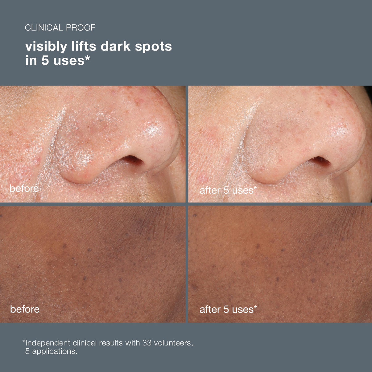 PowerBright Dark Spot Peel | Dermalogica®