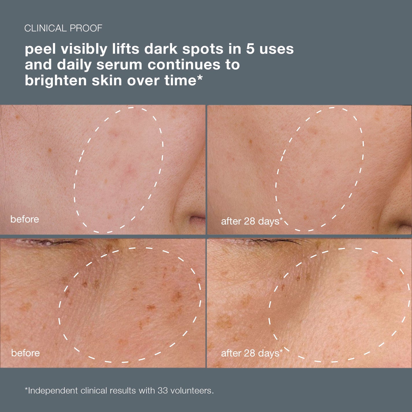 PowerBright Dark Spot System | Dermalogica®