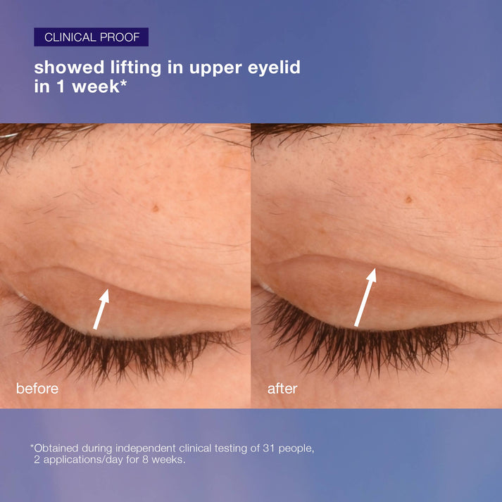 Phyto Nature Lifting Eye Cream | Dermalogica®