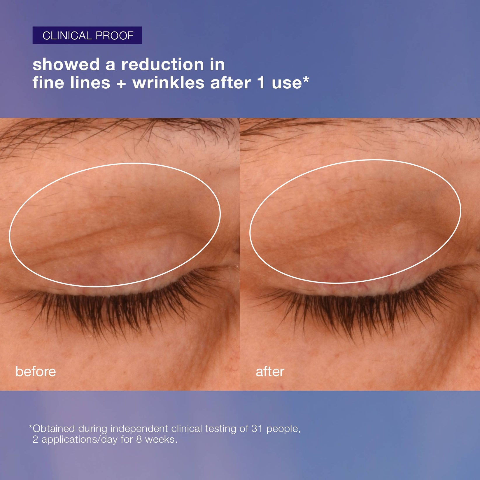Phyto Nature Lifting Eye Cream | Dermalogica®