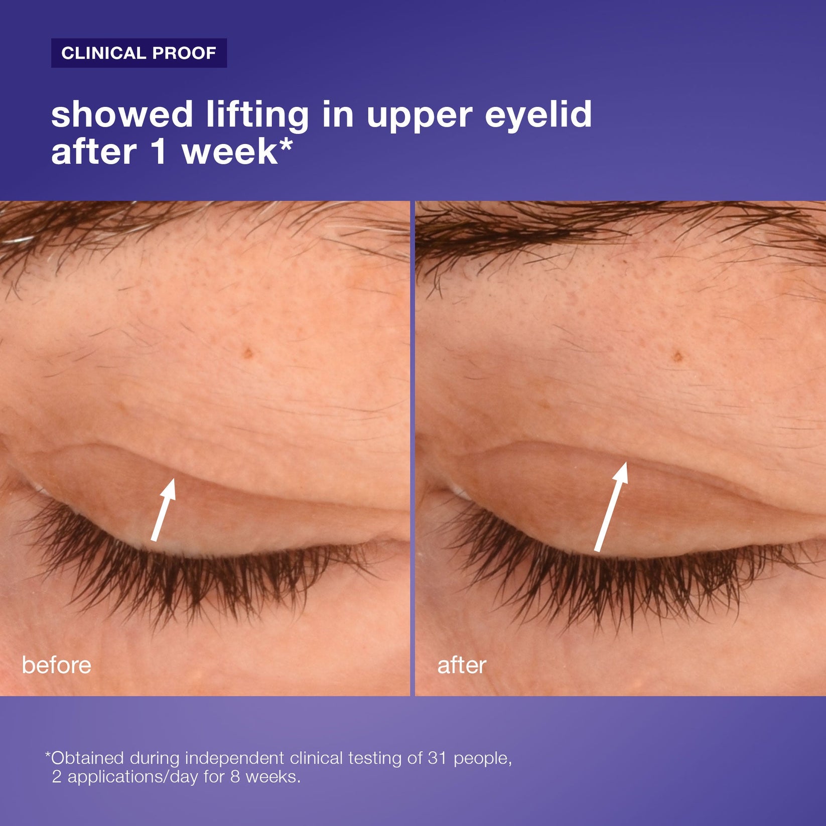 Phyto Nature Lifting Eye Cream | Dermalogica®