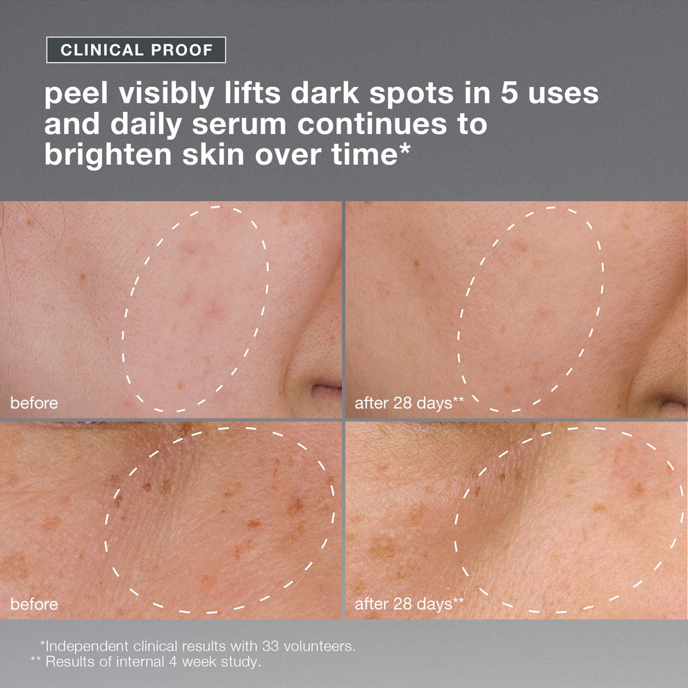 PowerBright Dark Spot System | Dermalogica®