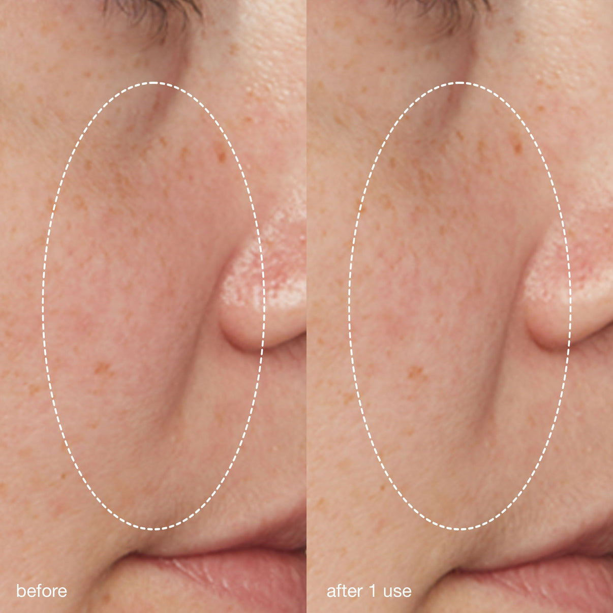 Liquid Peelfoliant At-Home Exfoliating Peel with Glycolic, Lactic, and ...